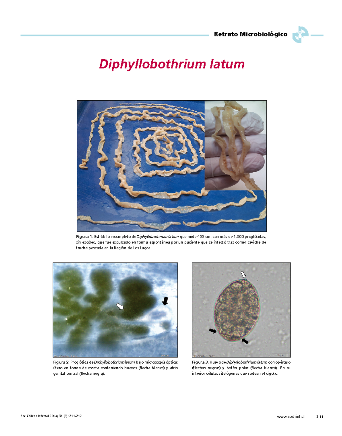 Art13 - Artes - Retrato Microbiológico sochinf 211 Diphyllobothrium ...