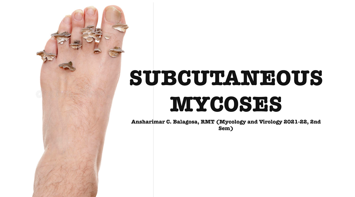 4- Sub Cutaneous Mycoses - SUBCUTANEOUS MYCOSES Ansharimar C. Balagosa ...