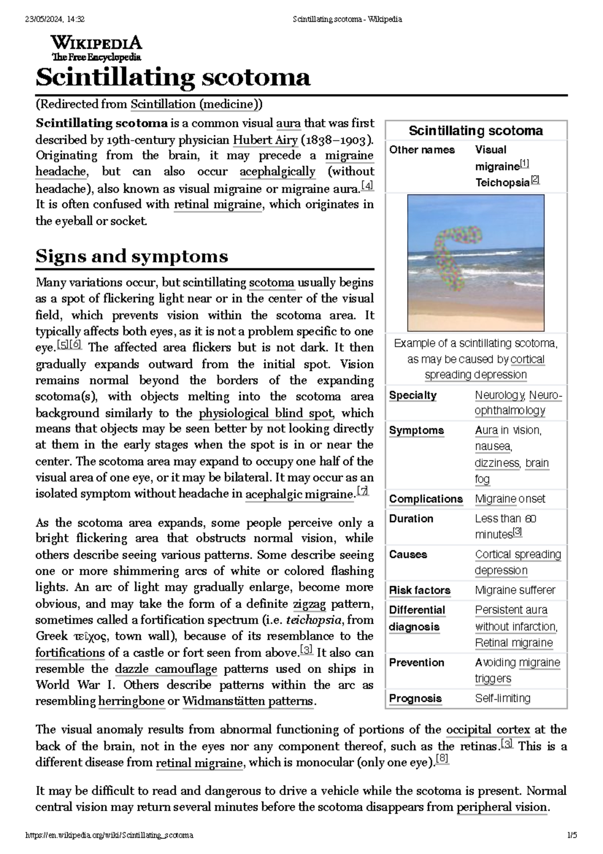 Scintillating scotoma - Wikipedia - Scintillating scotoma Other names ...