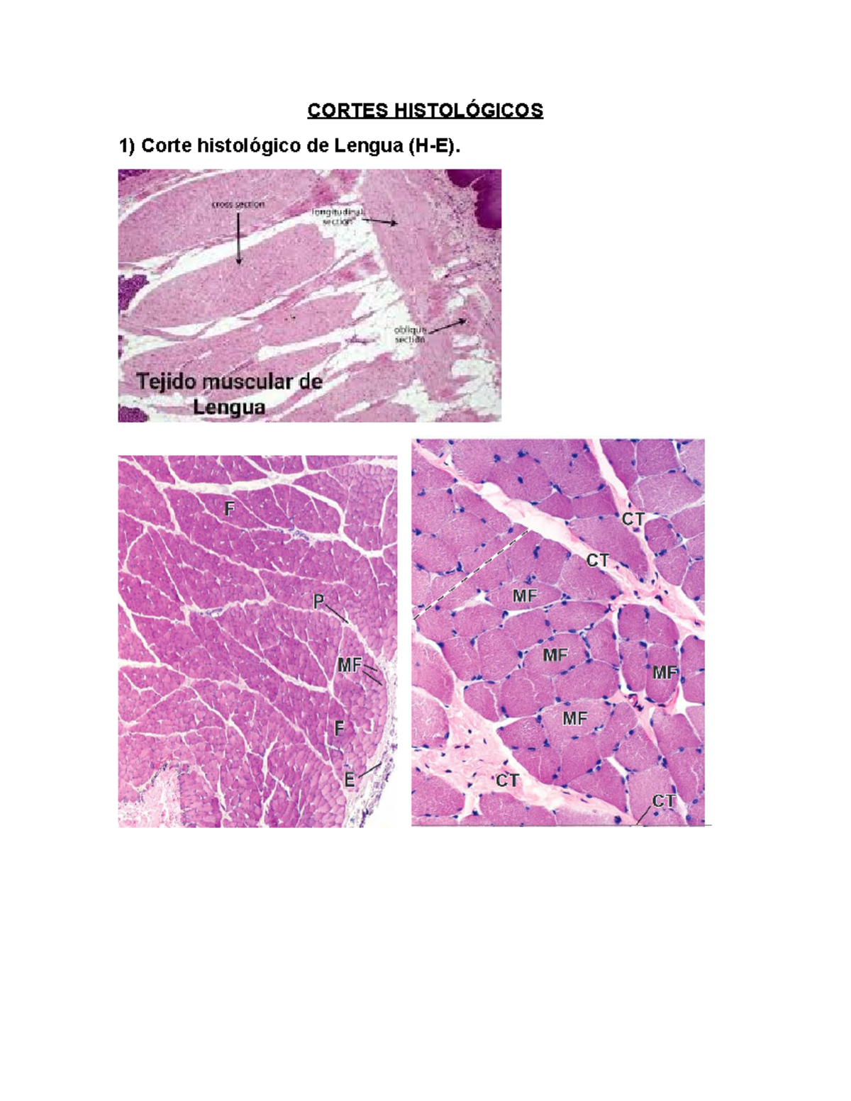 Cortes histológicos de tejido muscular - Histología - CORTES ...