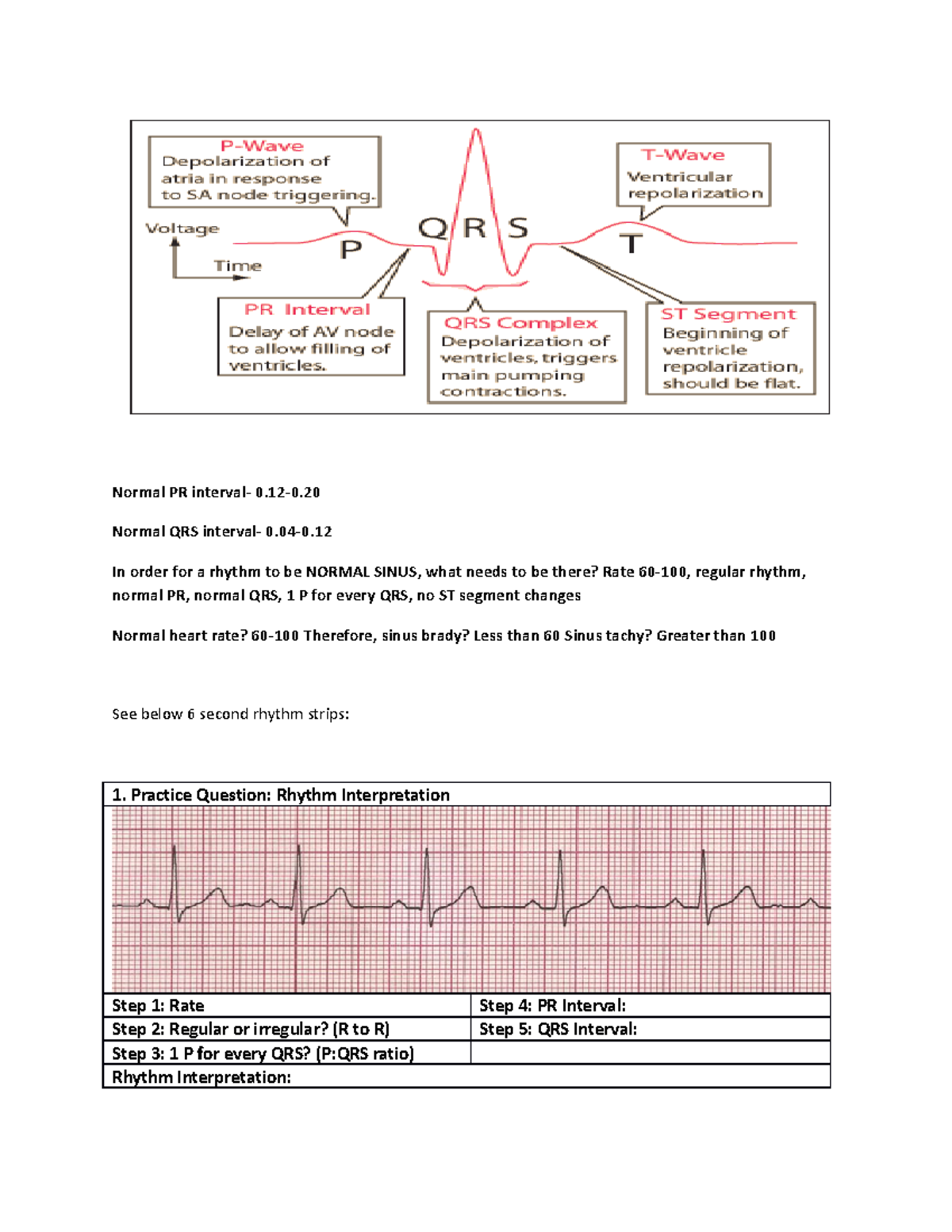 Practice EKG- student version - Normal PR interval- 0-0. Normal QRS ...
