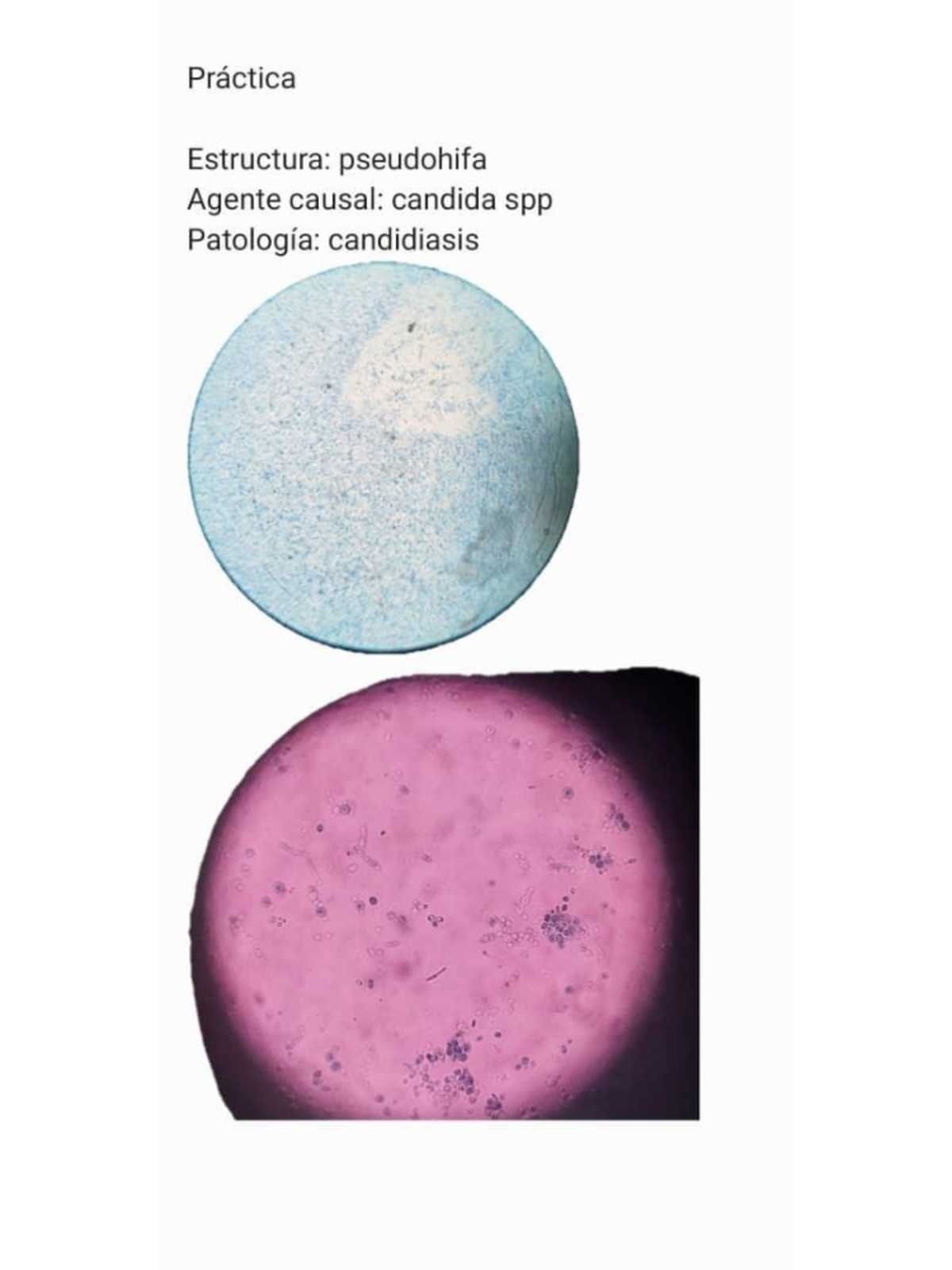 Parcial Micologia 1 - ...... - Práctica Estructura: pseudohifa Agente ...