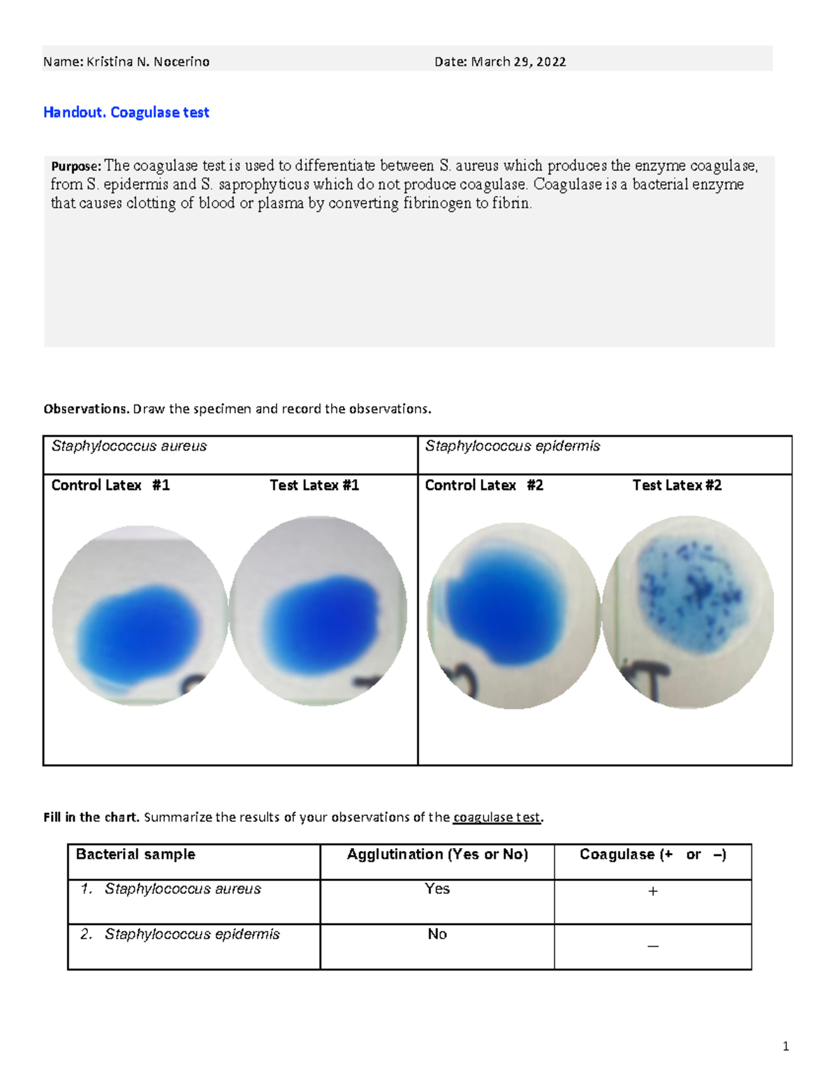 Coagulase test - for BIO 230 lab - 1 Name: Kris tina N. Nocerino Date ...