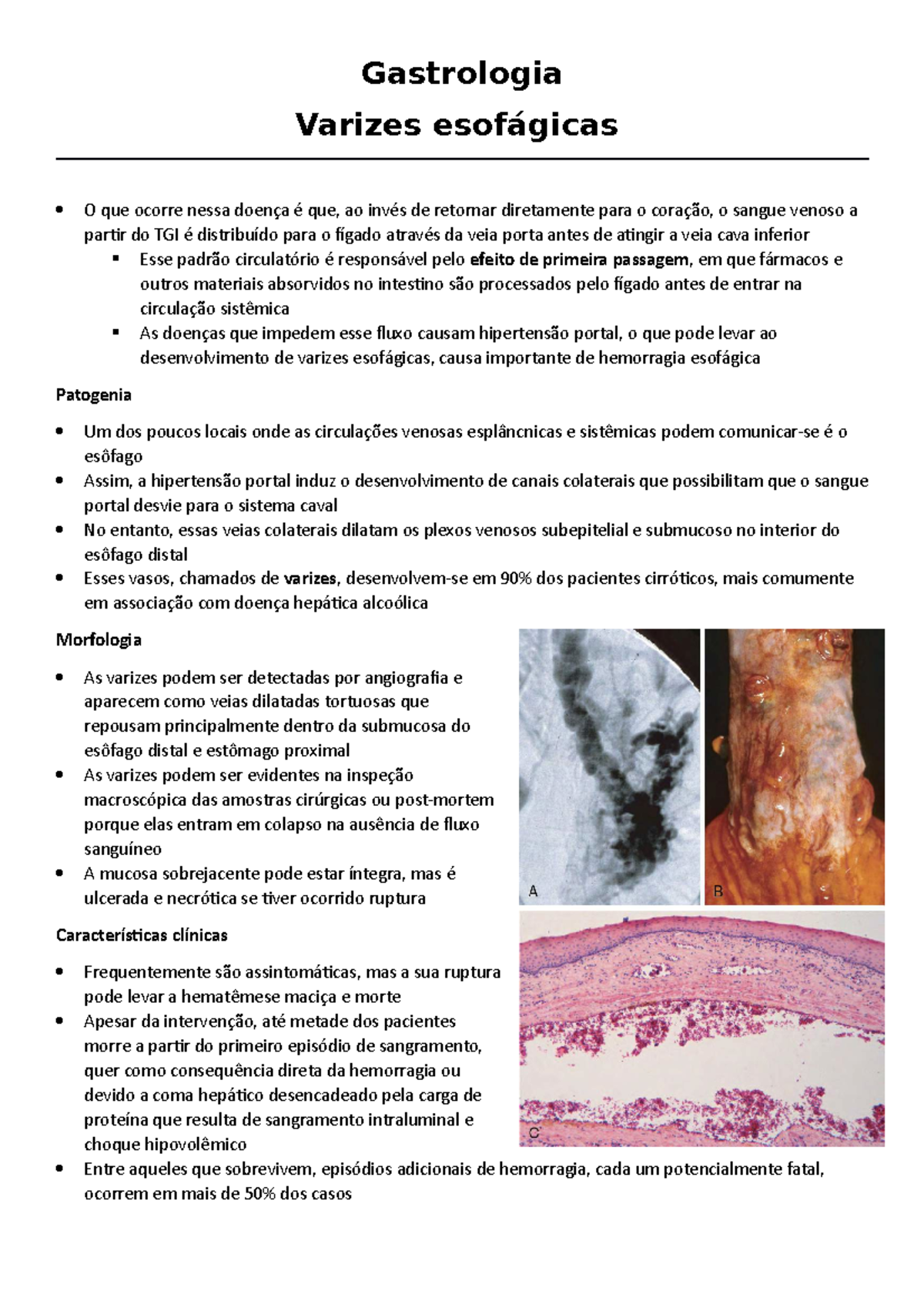 Gastrologia - Varizes esofágicas - Gastrologia Varizes esofágicas O que ...