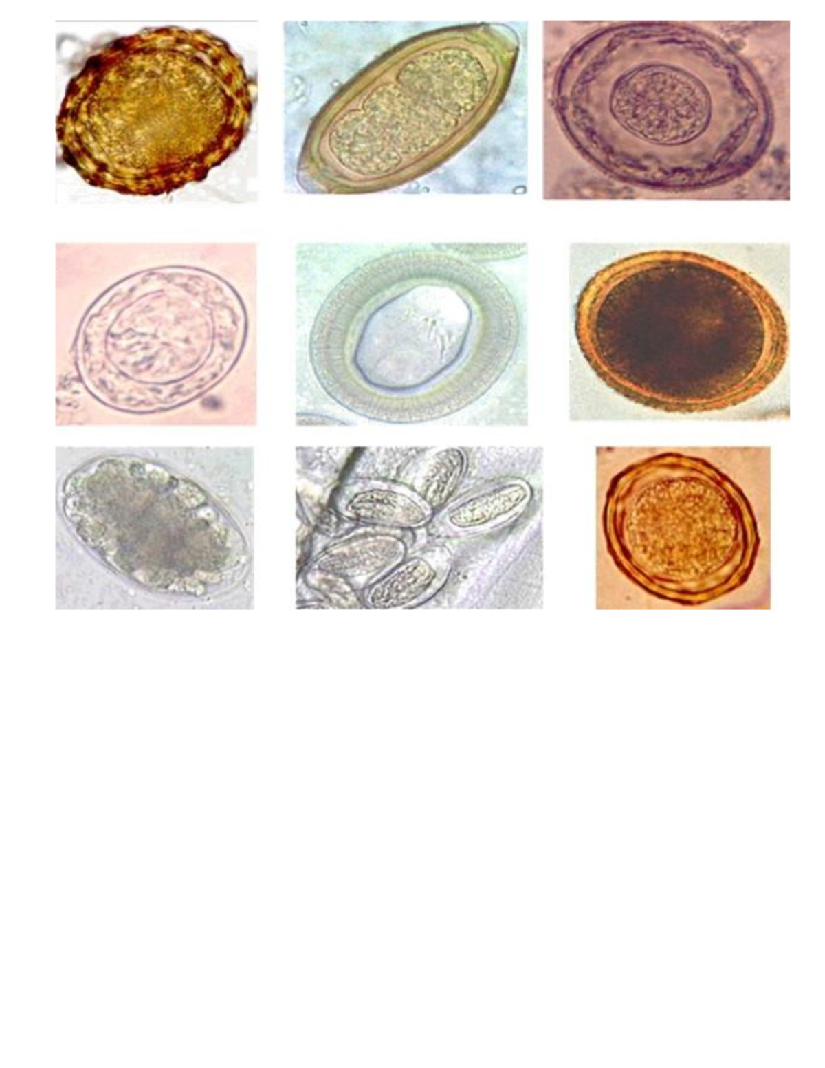 Oxiuriasis -trichuris - Enterobiasis y Oxiuriasis • Huevo blanco ...