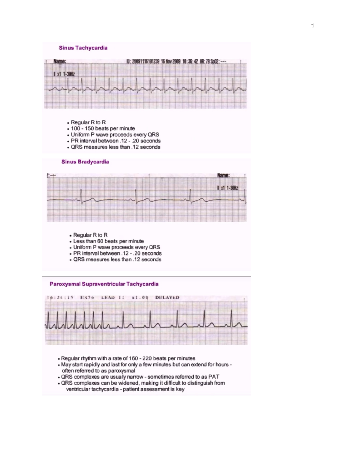Basic EKG Strip - NURS 240 - Studocu