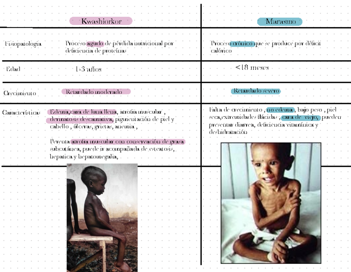 Pedía 2 - Cuadro comparativo desnutrición - Kwashiorkor Marasmo ...