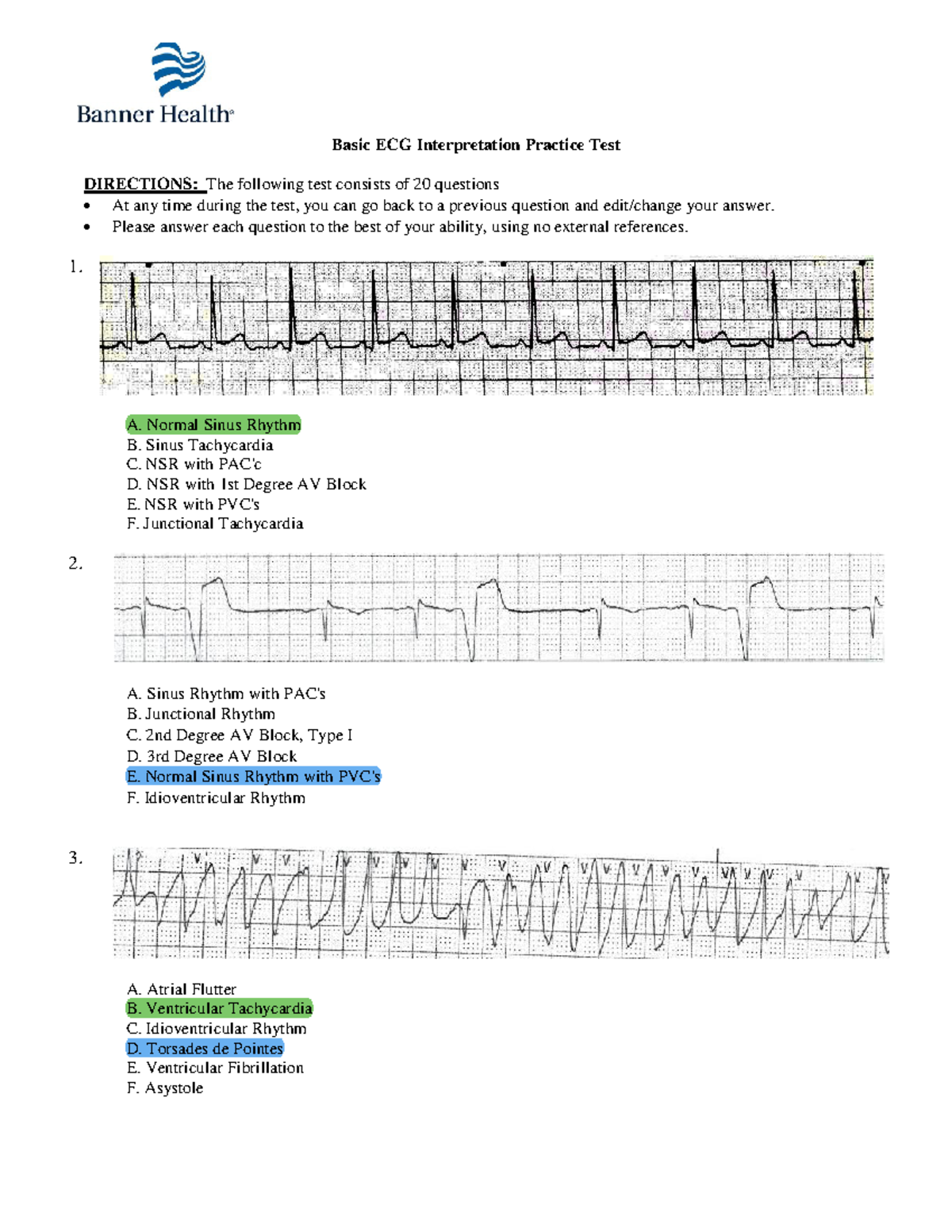 Basic ECGInterpretation Practice Testv 1 - Basic ECG Interpretation ...