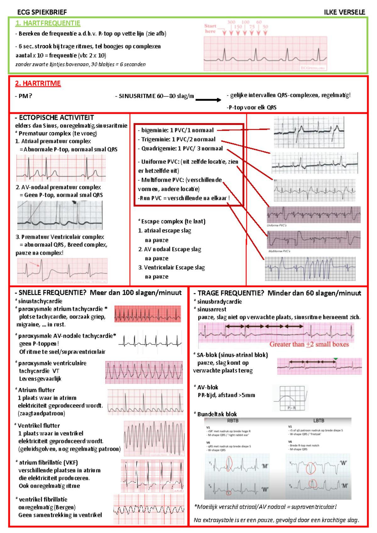 Ecg spiekbrief ilke versele - 1. HARTFREQUENTIE Bereken de frequentie a ...