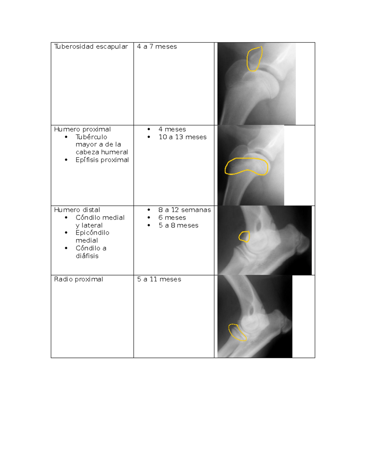 Lineas de crecimiento - Tuberosidad escapular 4 a 7 meses Humero ...