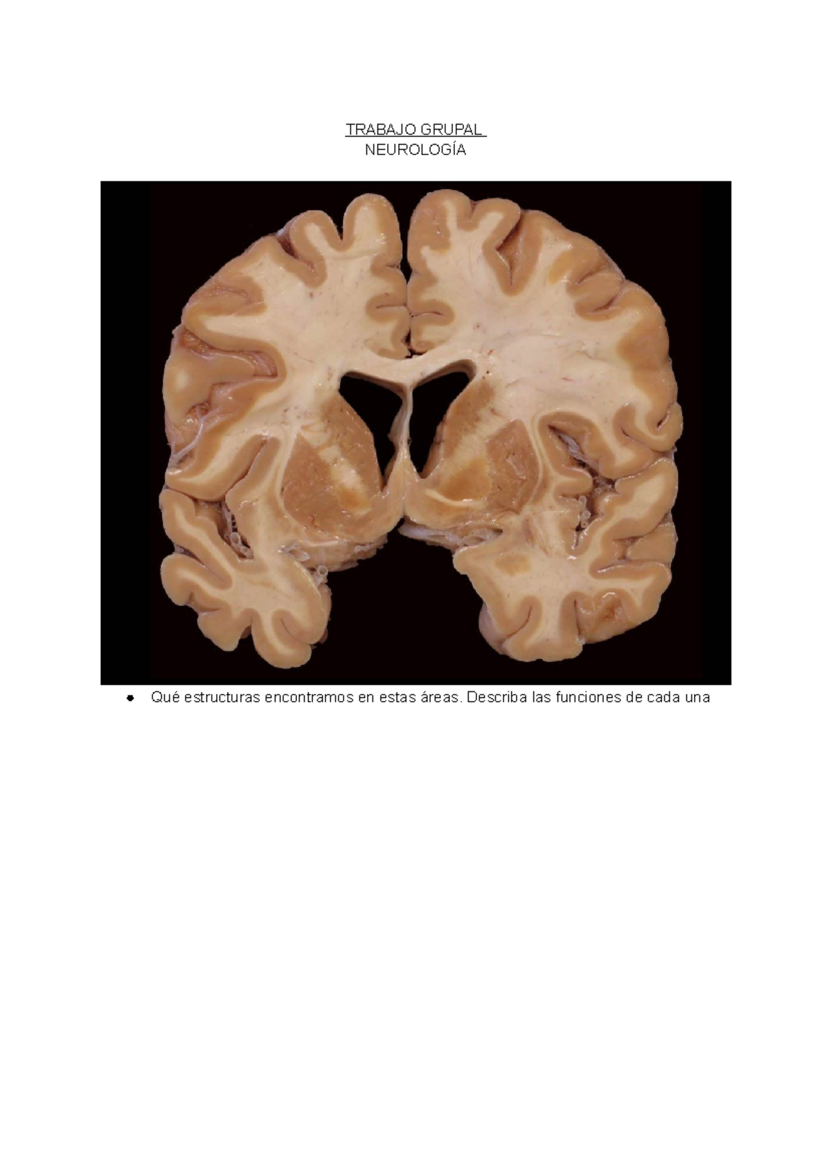 TP neuro - TRABAJO GRUPAL NEUROLOGÍA Qué estructuras encontramos en estas áreas. Describa las ...