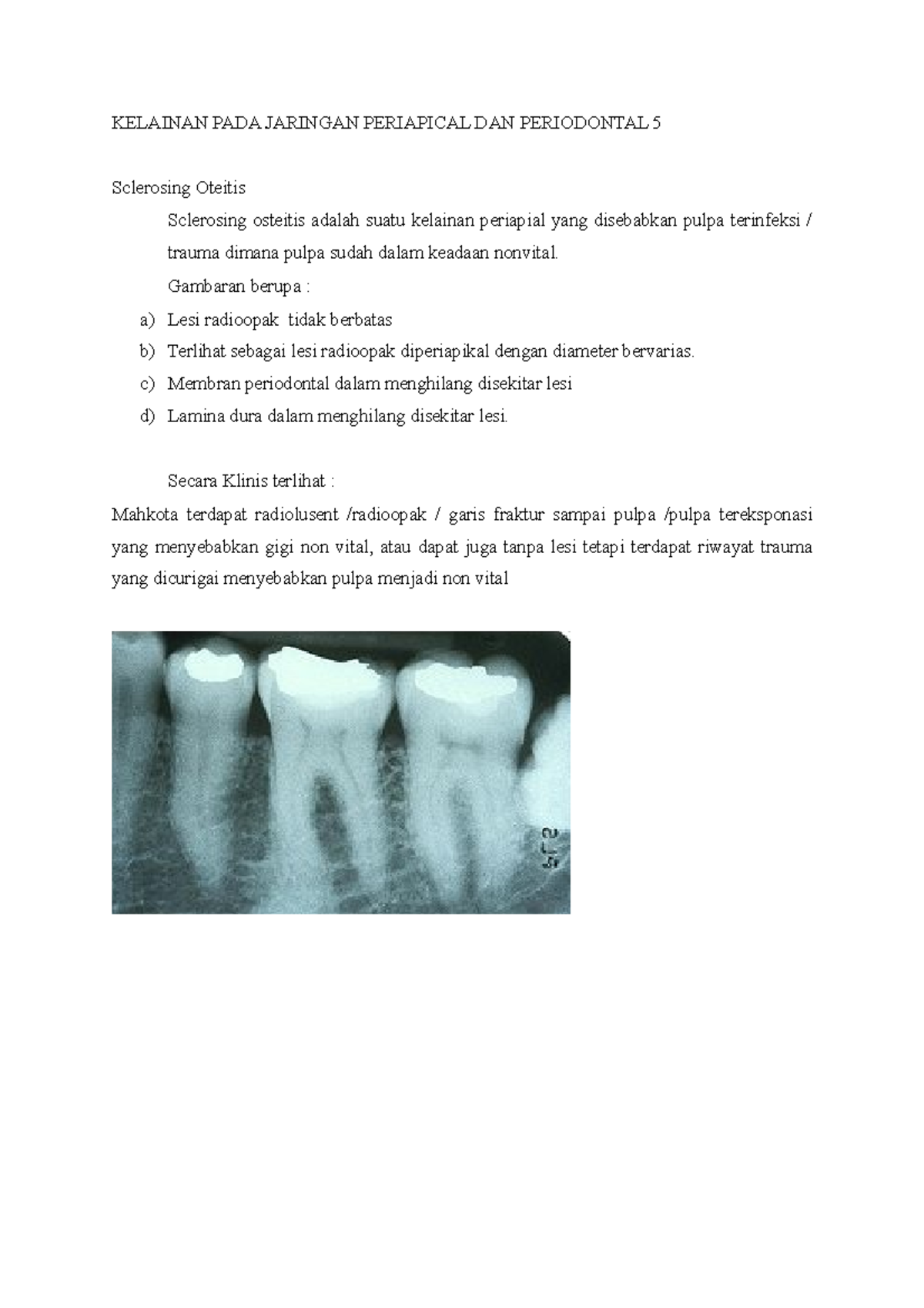 Kelainan Pada Jaringan Periapical Dan Periodontal 5 - KELAINAN PADA ...
