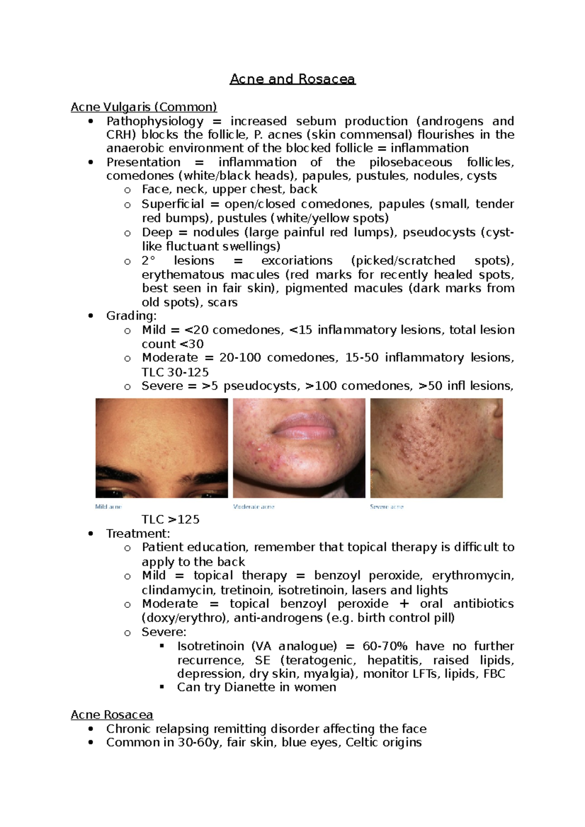 Acne and Rosacea - Acne and Rosacea Acne Vulgaris (Common ...