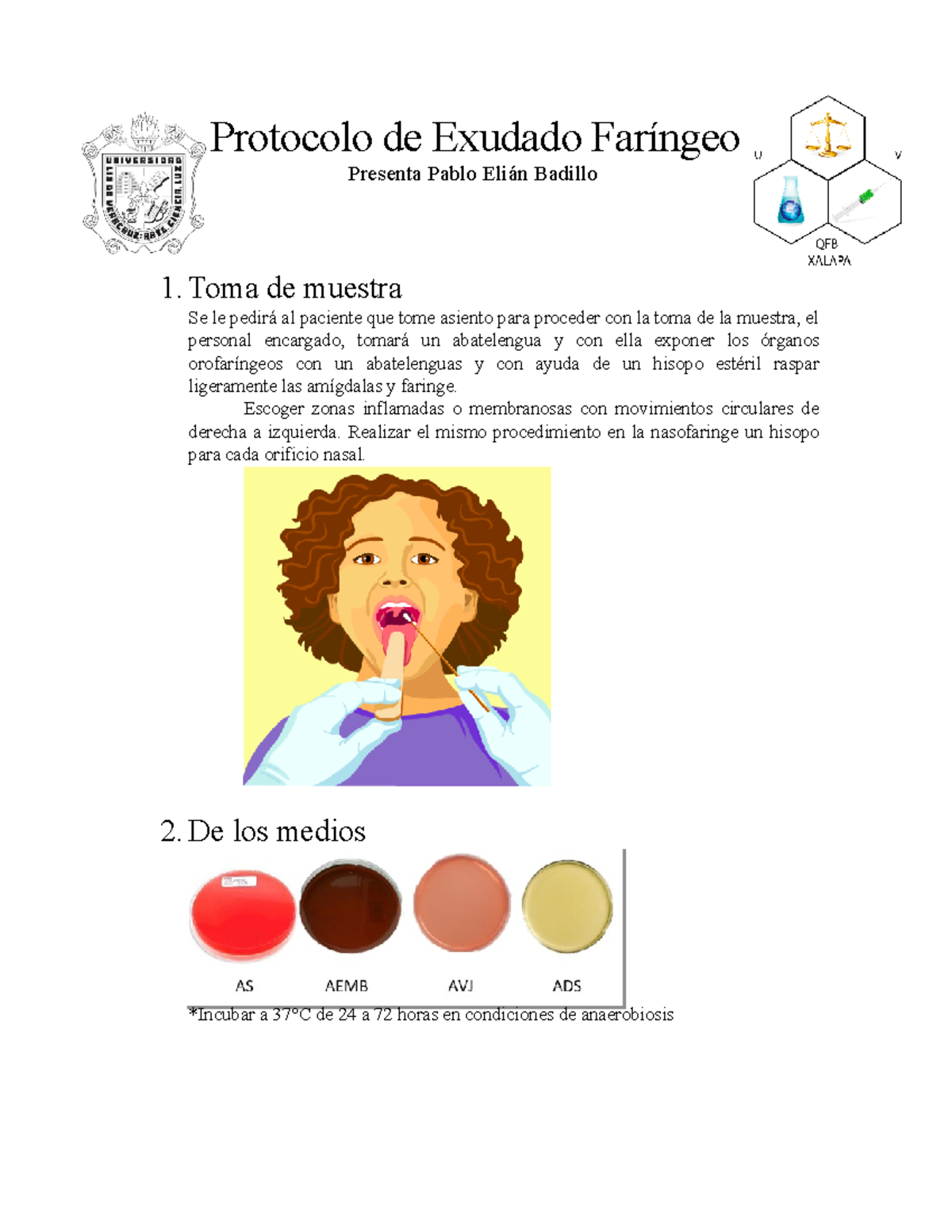 Protocolo de Exudado Faríngeo - Protocolo de Exudado Faríngeo Presenta ...