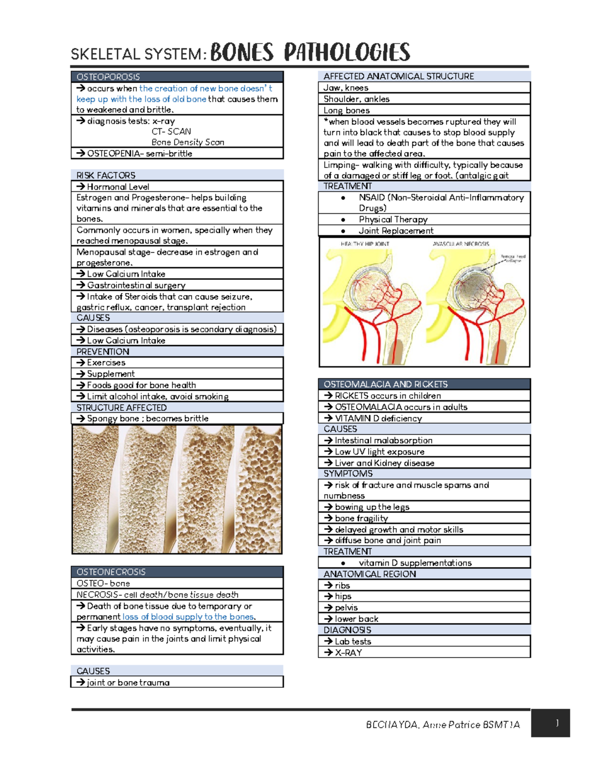 ANATOMY AND PHYSIOLOGY BONE Pathologies - OS TEOPOROS IS → occurs when ...