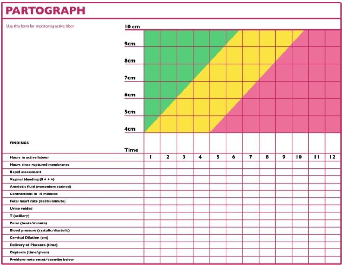 Partograph - lecture - BS Nursing - PARTOGRAPH Use this form for ...