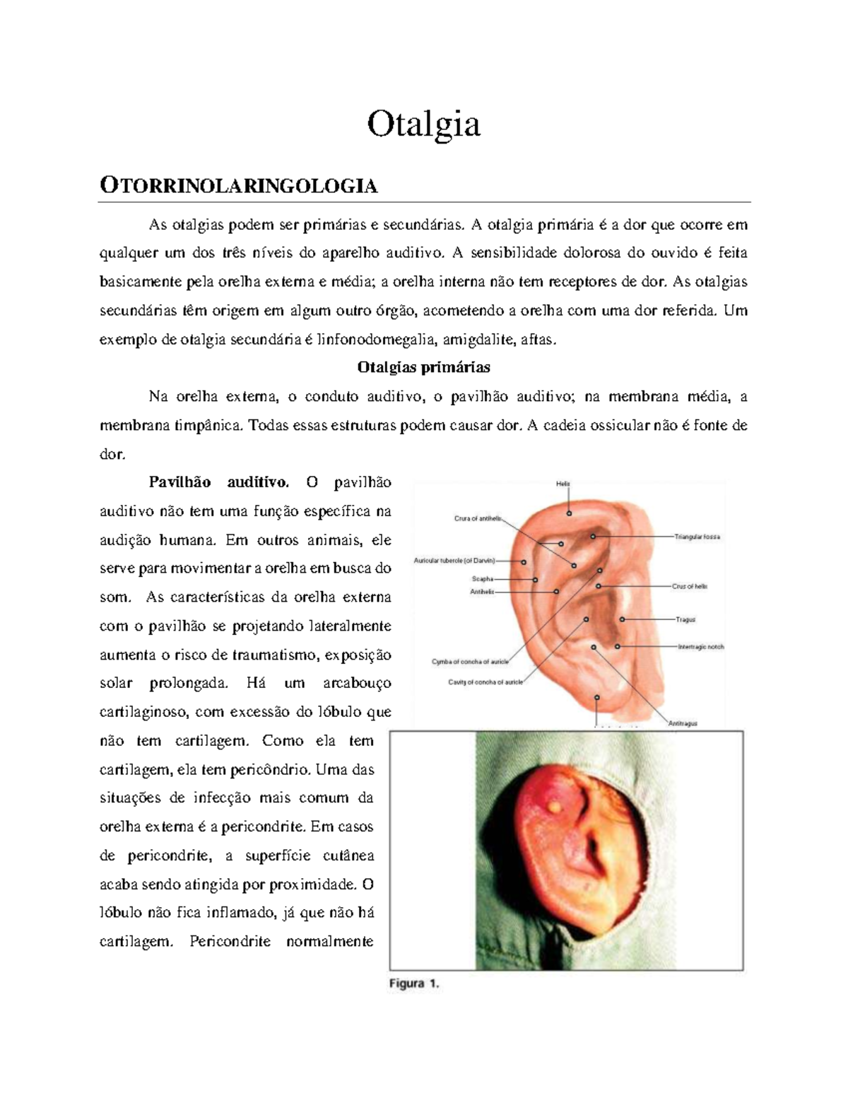 Otalgia - Resumo Otorrinolaringologia - Otalgia OTORRINOLARINGOLOGIA As ...
