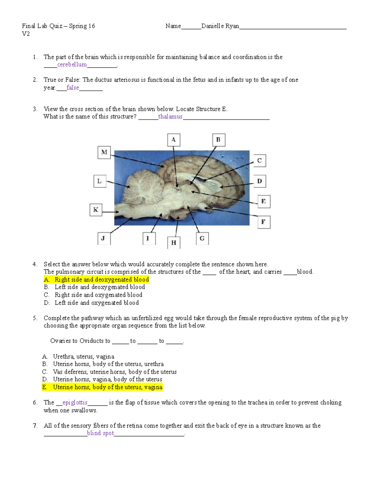 Final Lab Quiz V2 Lab Answers For Lab Quiz 2 Final Lab Quiz Spring 16 Namedanielle