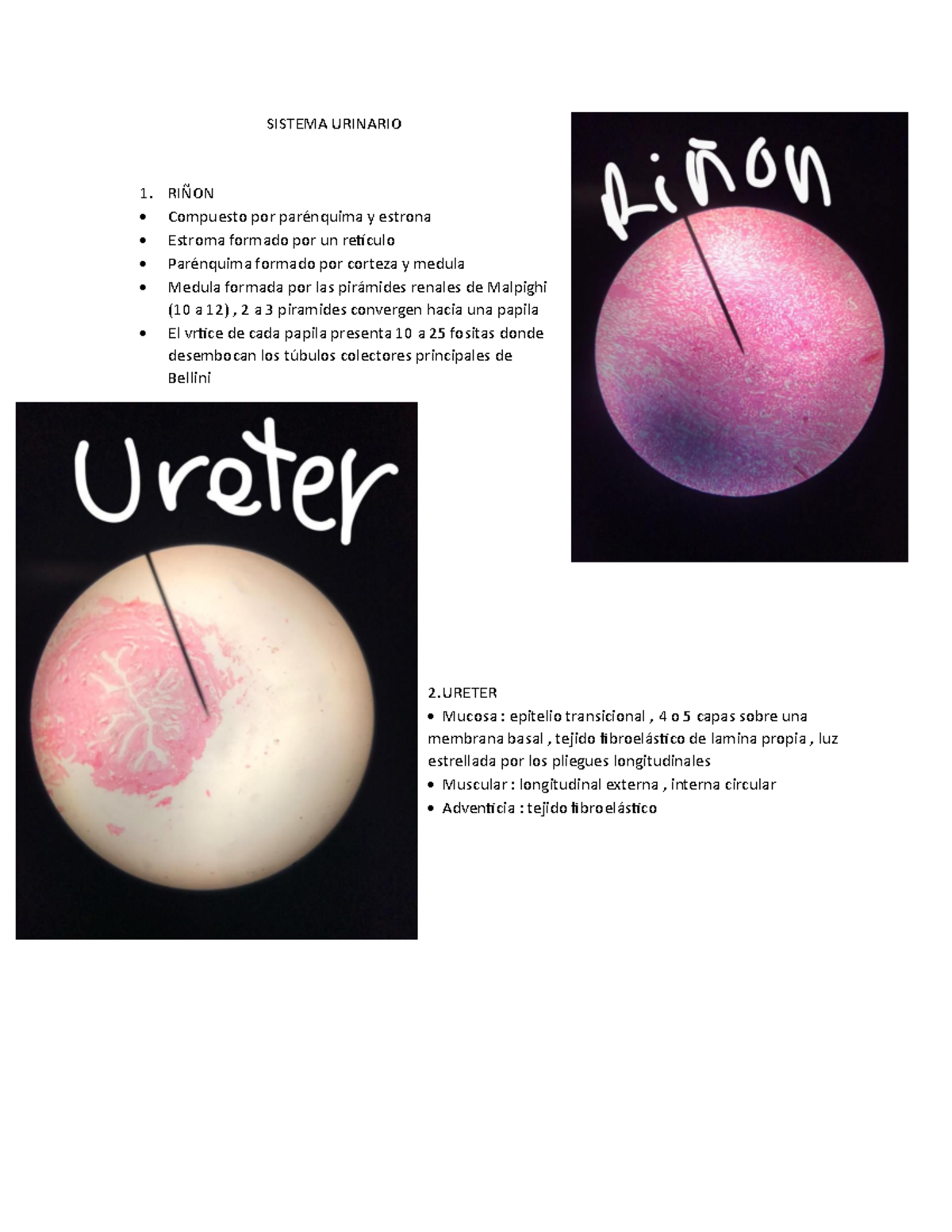 Organo LAB 3ER Parcial - SISTEMA URINARIO 1. RIÑON Compuesto por parénquima y estrona Estroma ...
