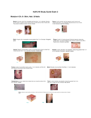 HAROLD STEVENS- HEART FAILURE - Module Report Achieved Intervention ...