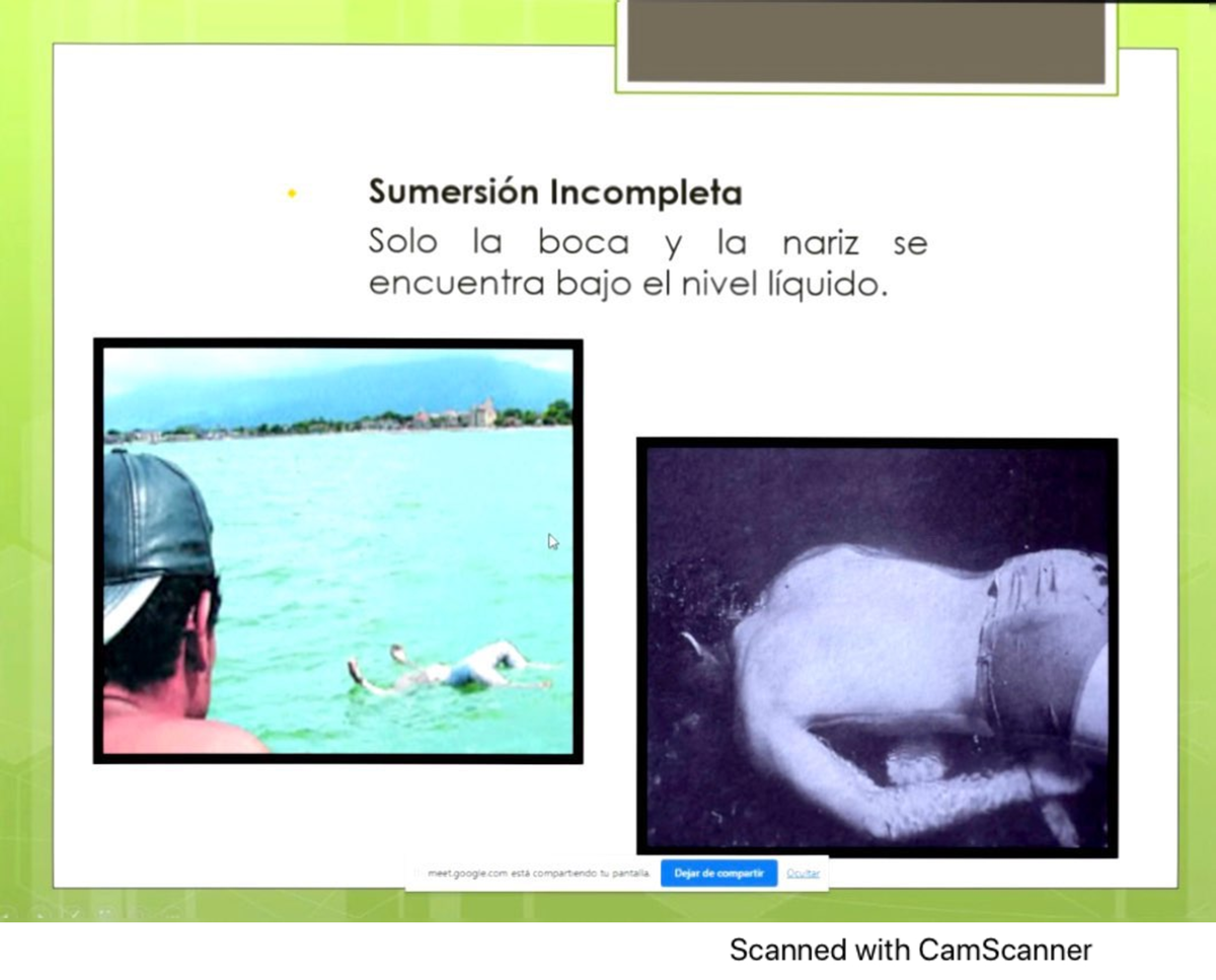 Sumersion- Necropsia - Sumersión Incompleta Solo la boca y la nariz se ...