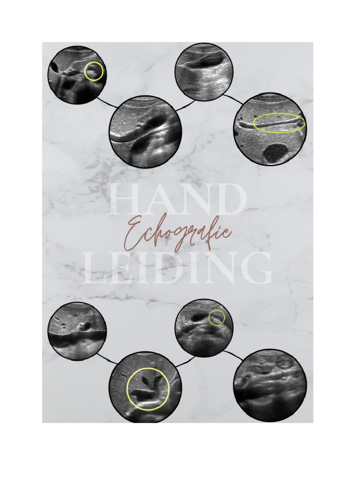 Handeleiding Galwegen ( Ductus Choledochus & Pancreas) - Echografie ...