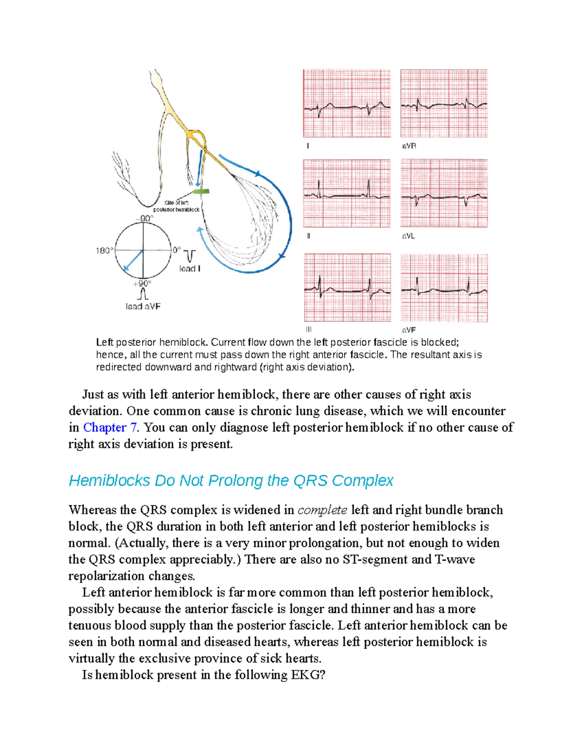 The only EKG-70 - The only EKG - Left posterior hemiblock. Current flow ...