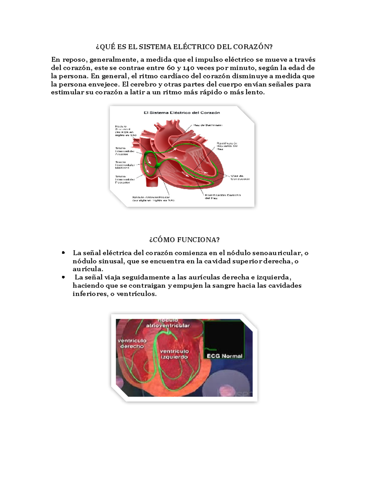 Sistema electrico del corazón - ¿QUÉ ES EL SISTEMA ELÉCTRICO DEL ...