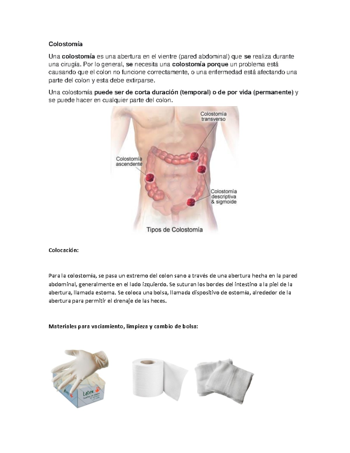 Colostomia - Material para colostomía. - Colostomía Una colostomía es ...