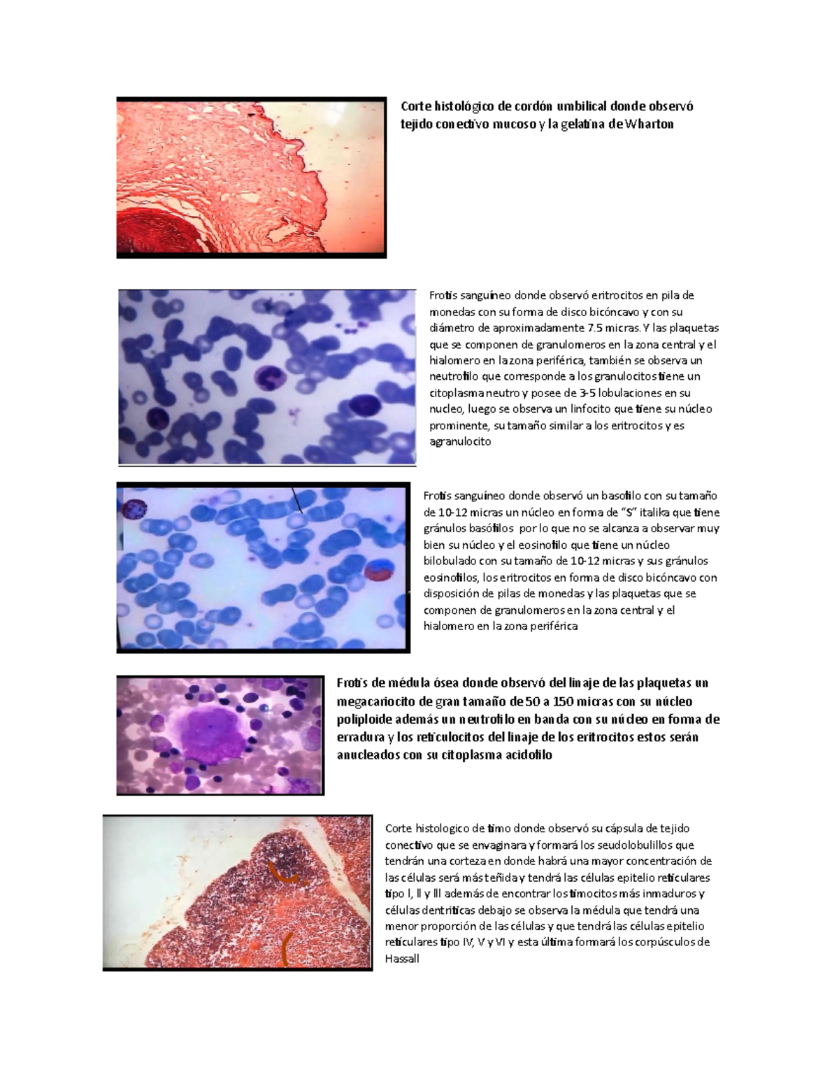 Cortes histologicos - Corte histológico de cordón umbilical donde ...