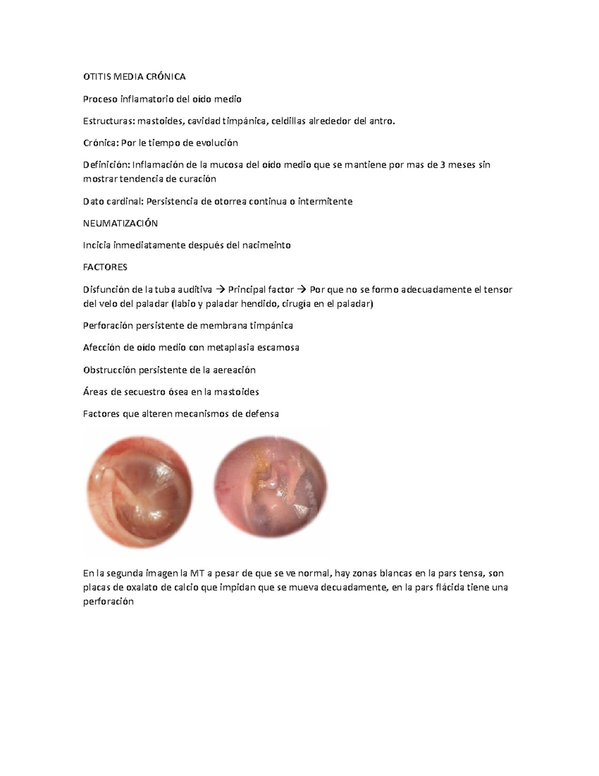 Otitis Media Crónica - OTITIS MEDIA CRÓNICA Proceso inflamatorio del ...