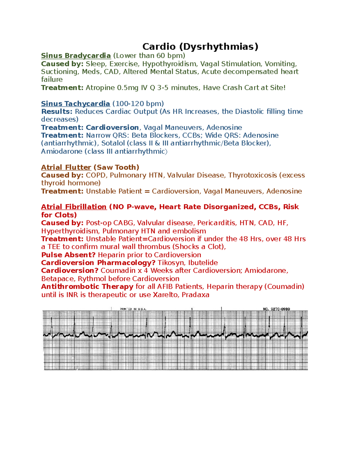 EKG Dysrhythmias with charts - Cardio (Dysrhythmias) Sinus Bradycardia ...