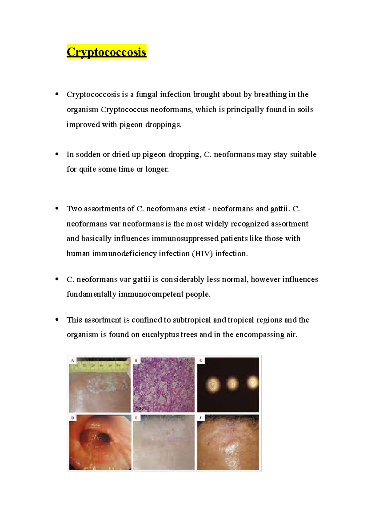 Cryptococcosis - useful lecture notes - Cryptococcosis Cryptococcosis ...