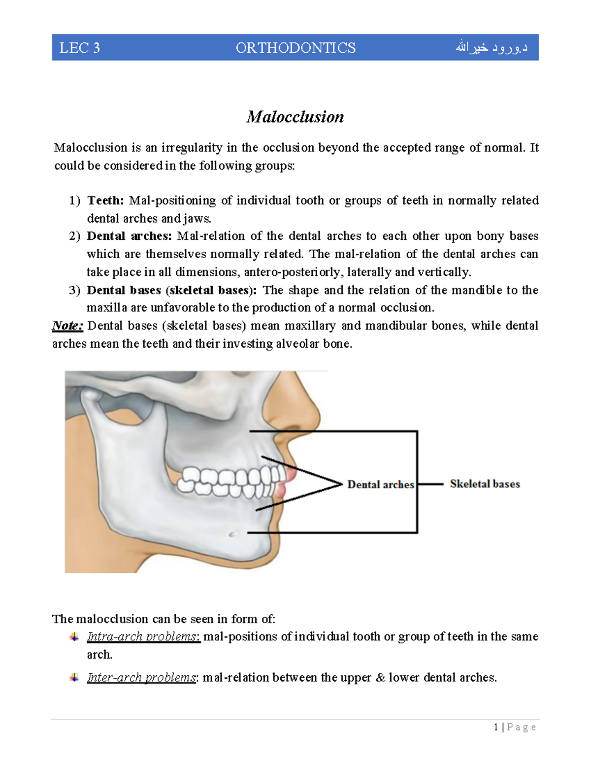 Lec 3 Malocclusion - physiology - Malocclusion Malocclusion is an ...