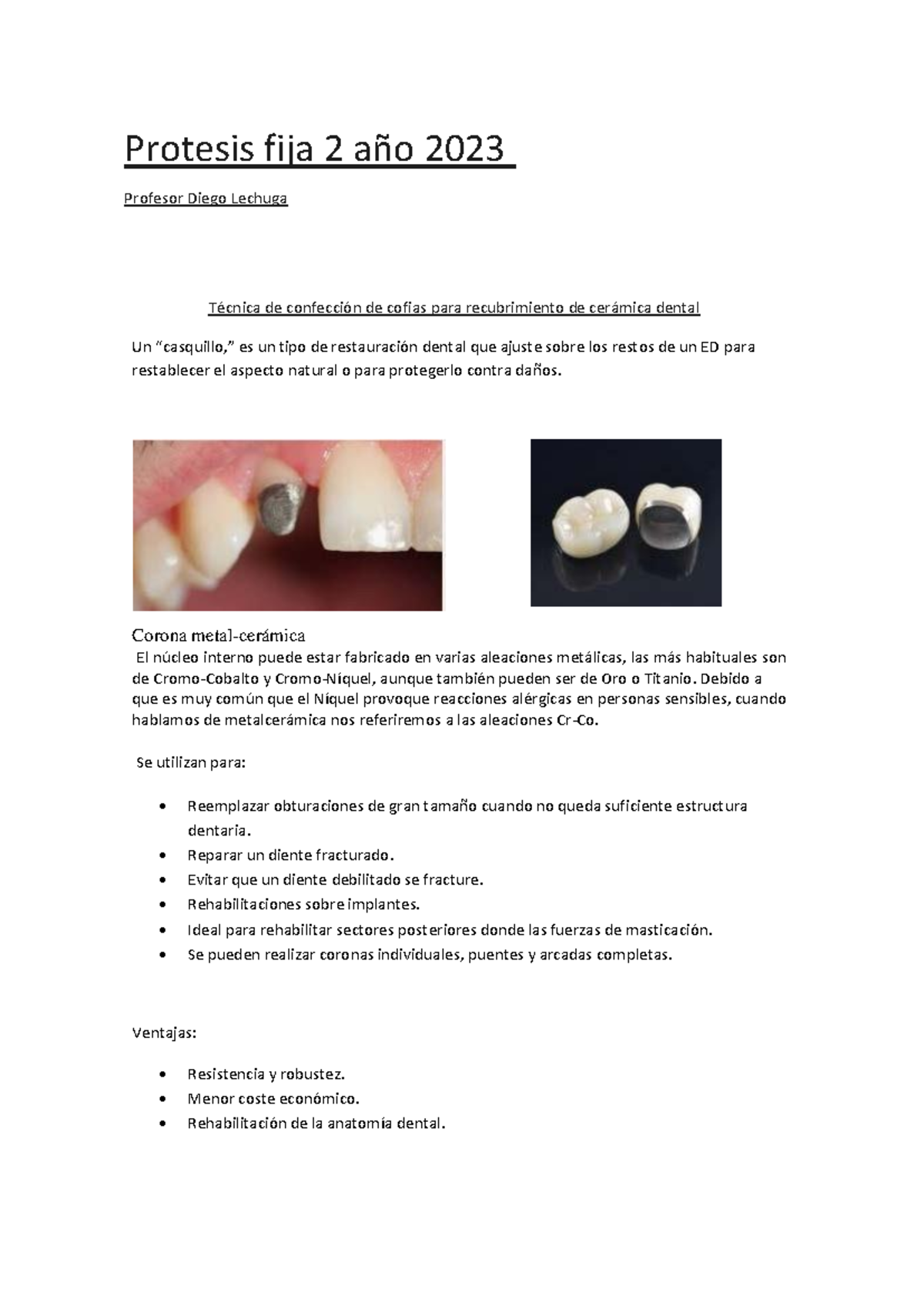Protesis FIJA 2 Casquillos 2023 - Protesis fija 2 aÒo 2023 Profesor ...