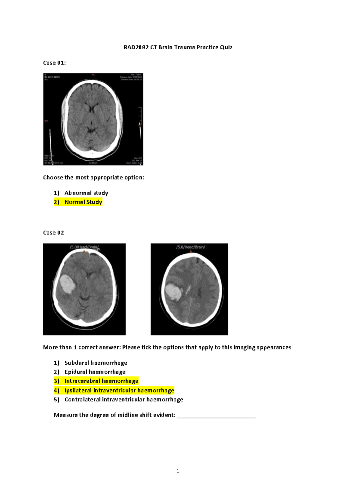 CT Head Trauma Practice Bank Quiz Answers - 1 RAD2092 CT Brain Trauma ...