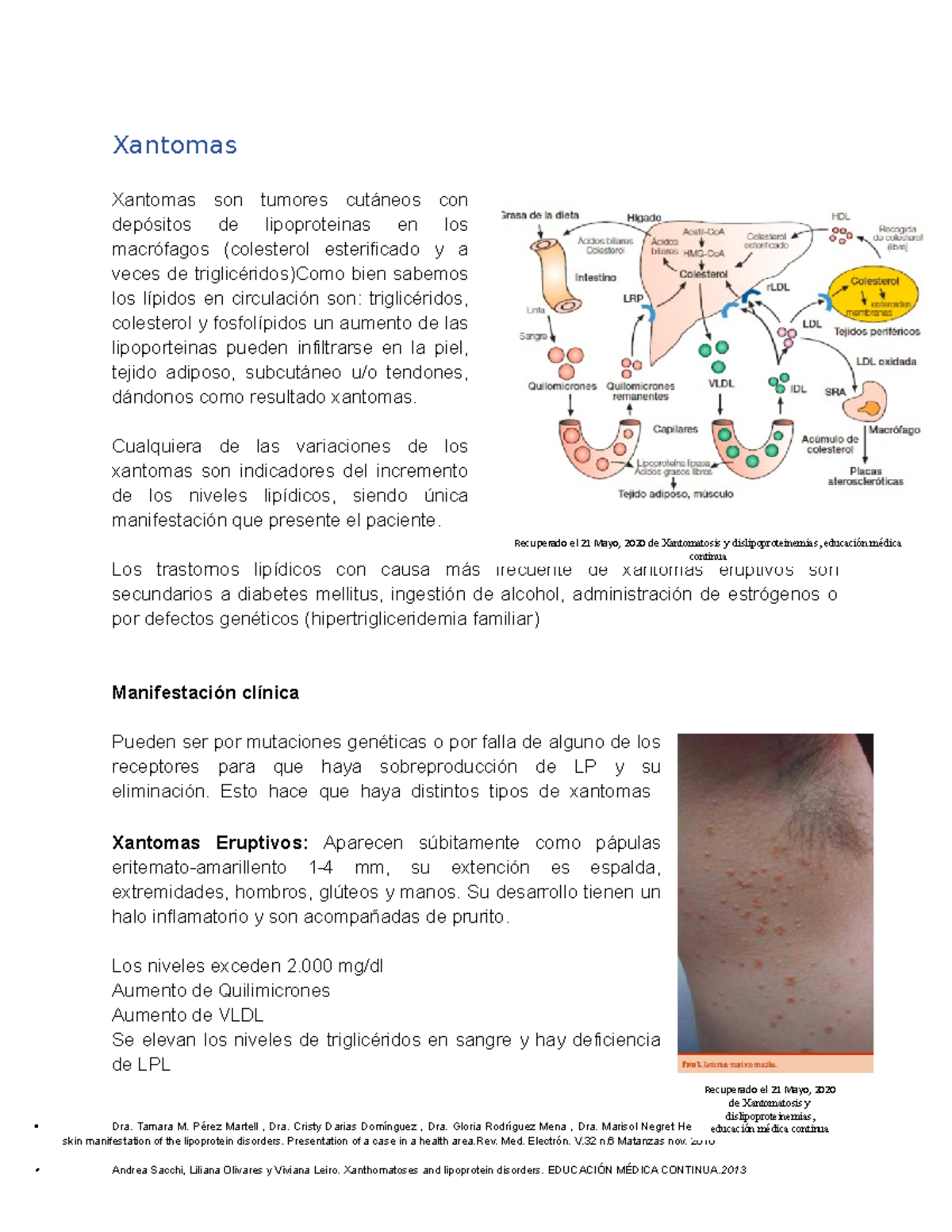 Xantomas - Xantomas Xantomas son tumores cutáneos con depósitos de ...