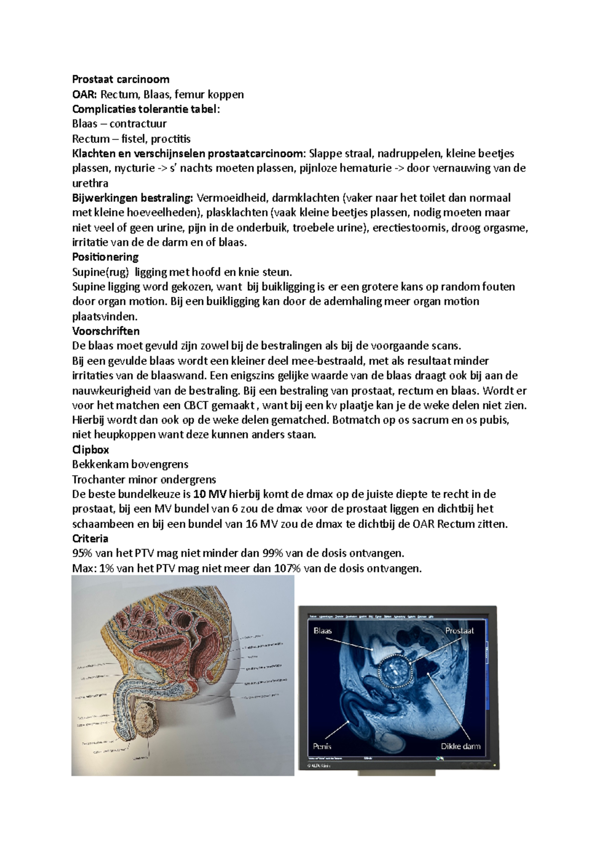 Prostaat carcinoom assessment - Prostaat carcinoom OAR: Rectum, Blaas ...