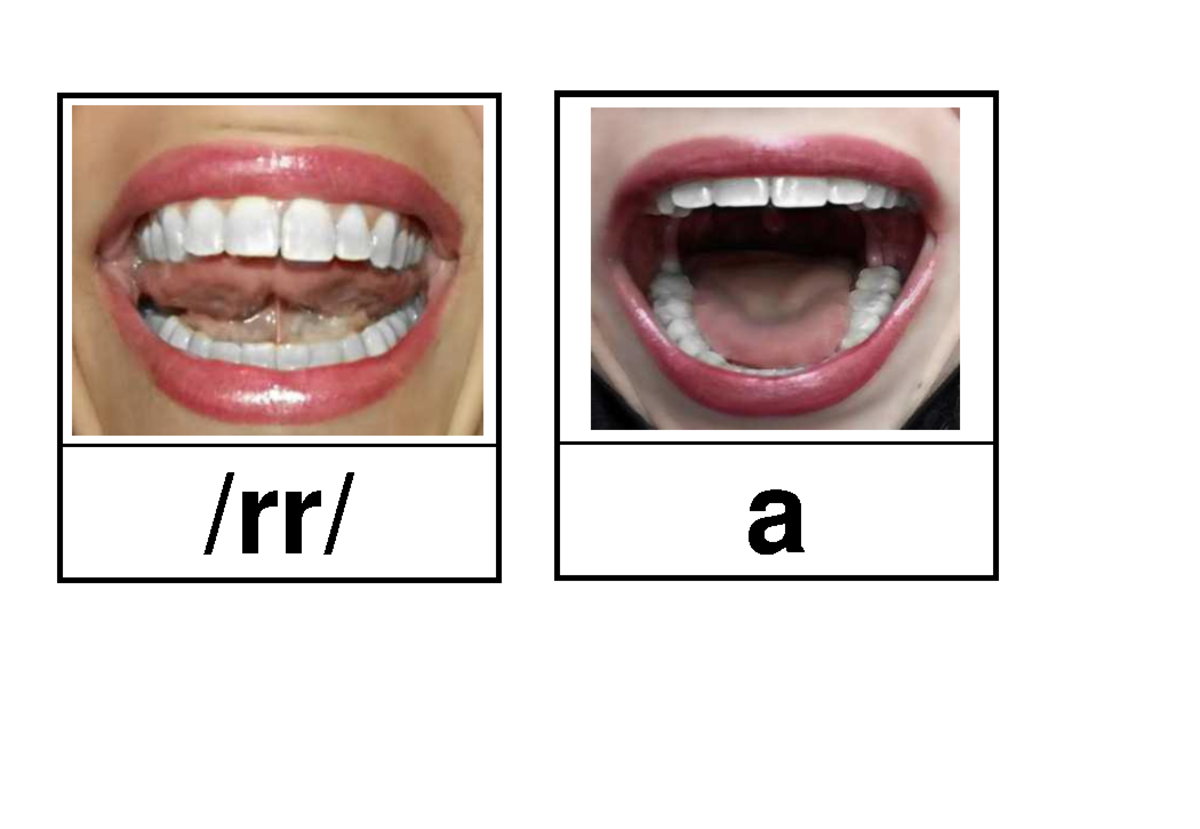 Rr - laminas para actividad con /R/ - audiologia - /rr/ a e i - Studocu