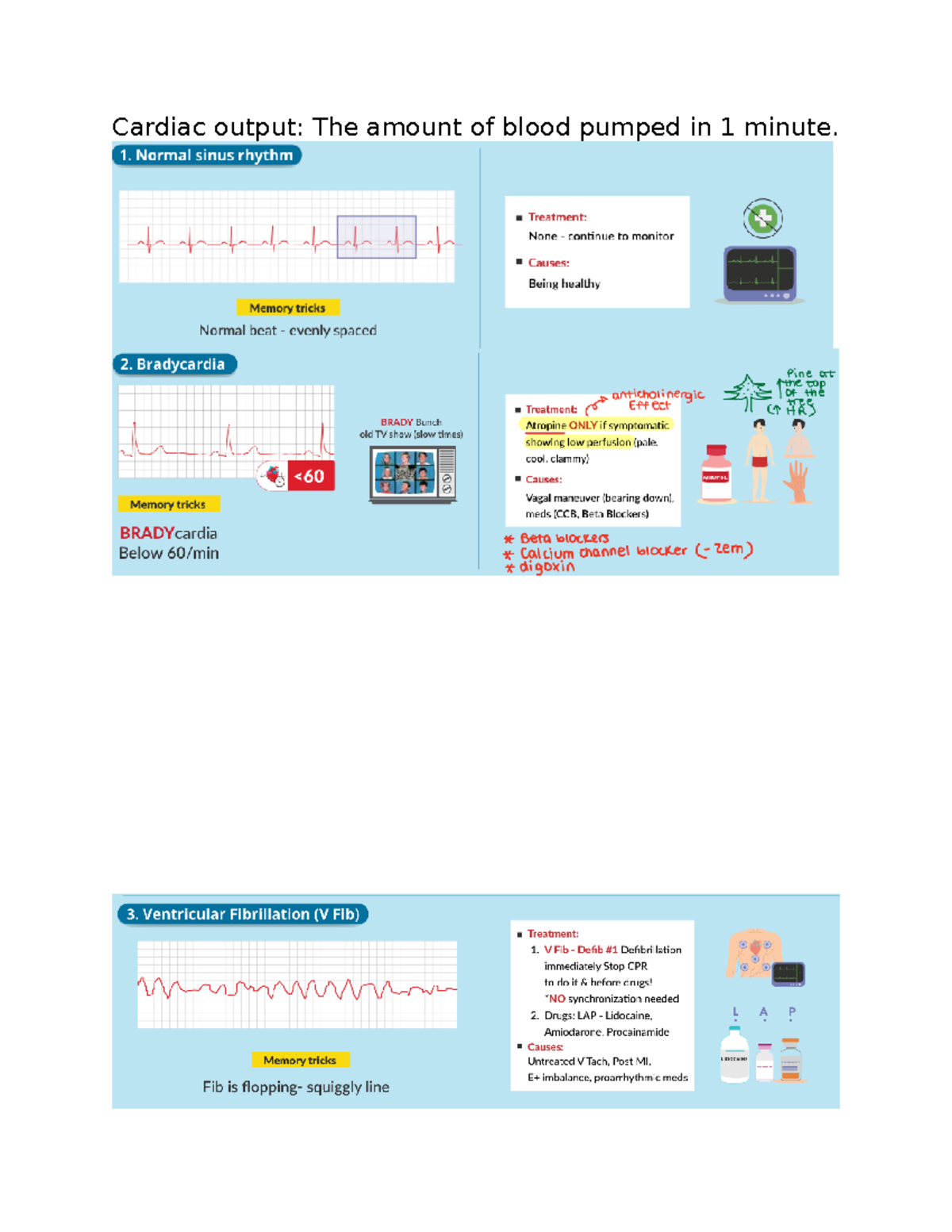 EKG: Cardiac problems - Cardiac output: The amount of blood pumped in 1 ...