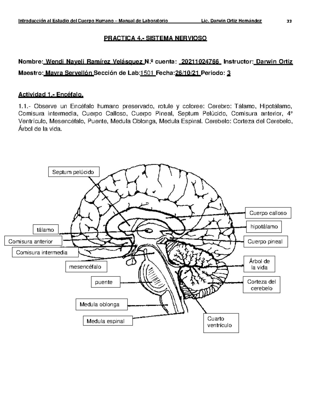Sistema nervioso actividad 1 de 45 actividades skfkfksks - PRACTICA 4.- SISTEMA NERVIOSO Nombre ...
