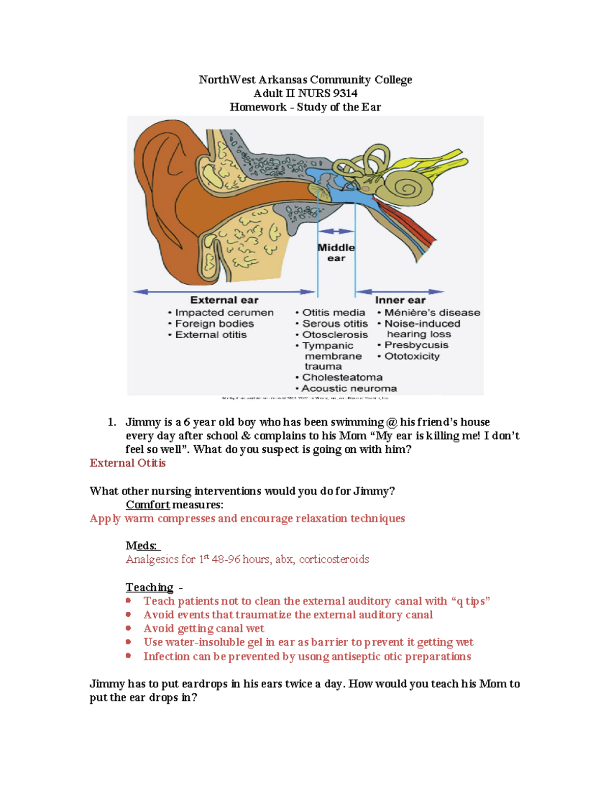 Ear Disorders - NorthWest Arkansas Community College Adult II NURS 9314 ...