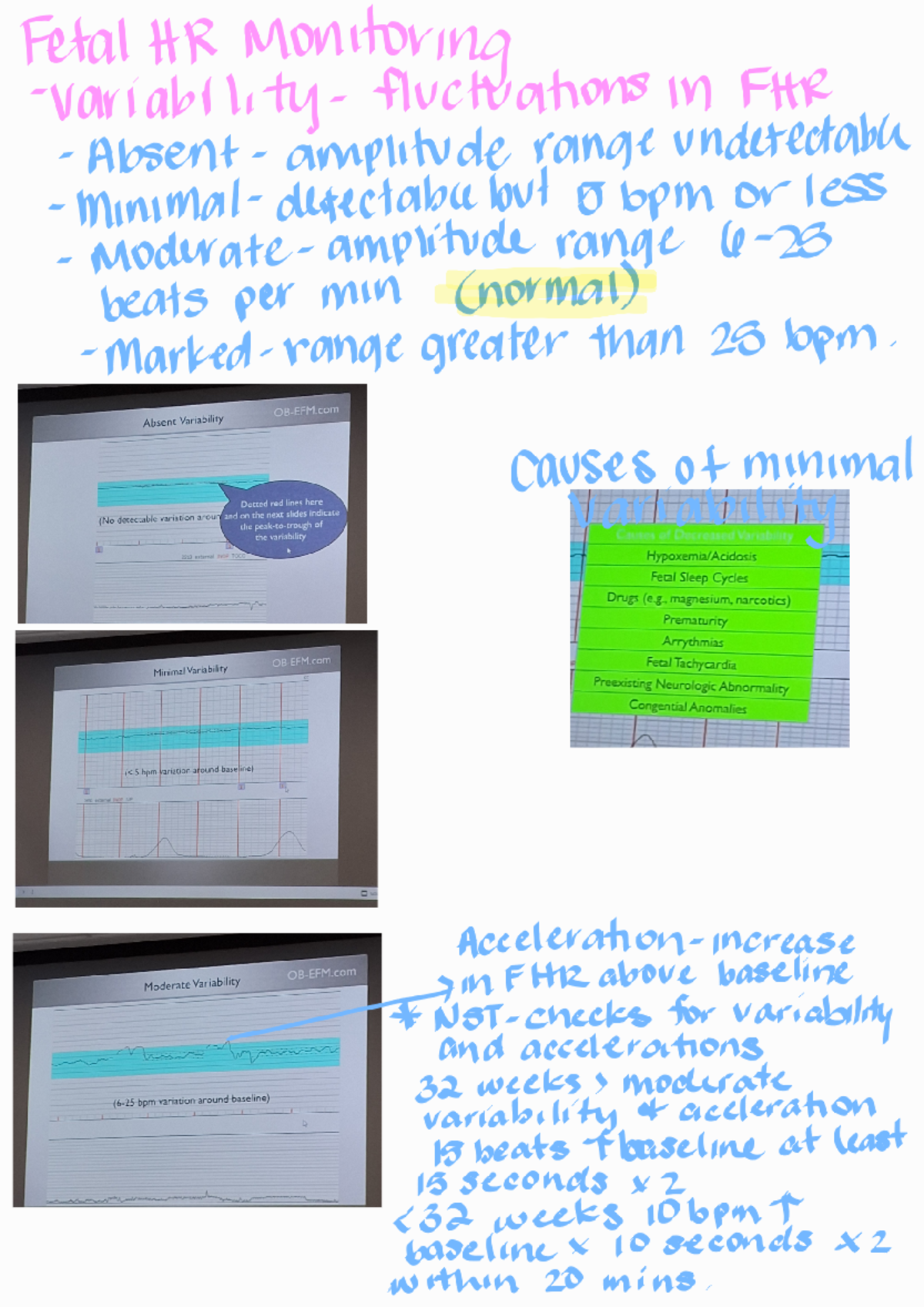 OB lab notes reading strips - Fetal HR Monitoring fluctuations in FHR ...
