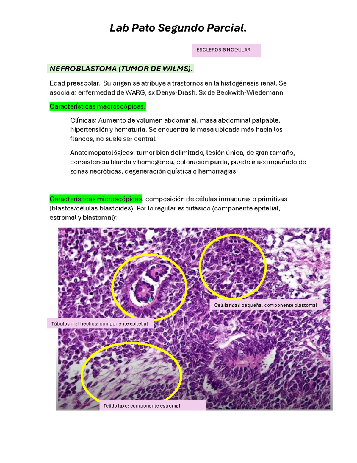 2Parcial Lab Pato - NEFROBLASTOMA (TUMOR DE WILMS). Edad preescolar. Su ...