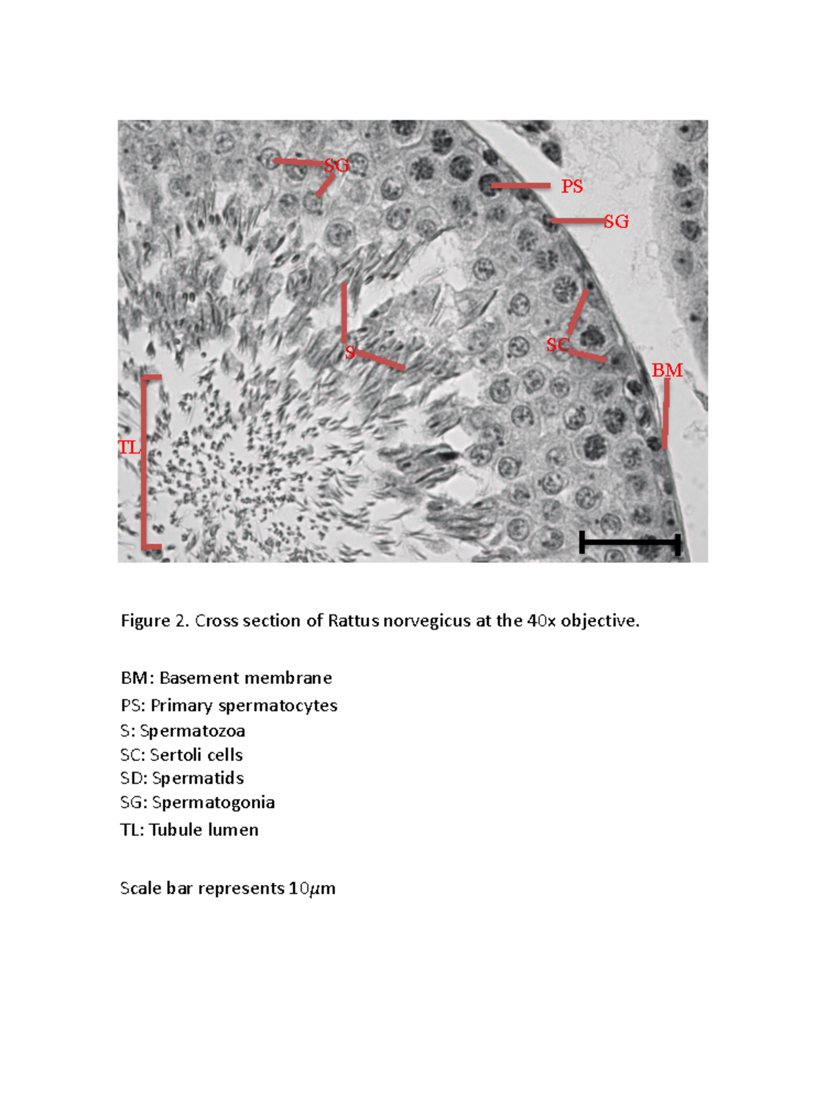 Rat testicle 40x - Bio lab report - BIO1130 - Figure 2. Cross section ...