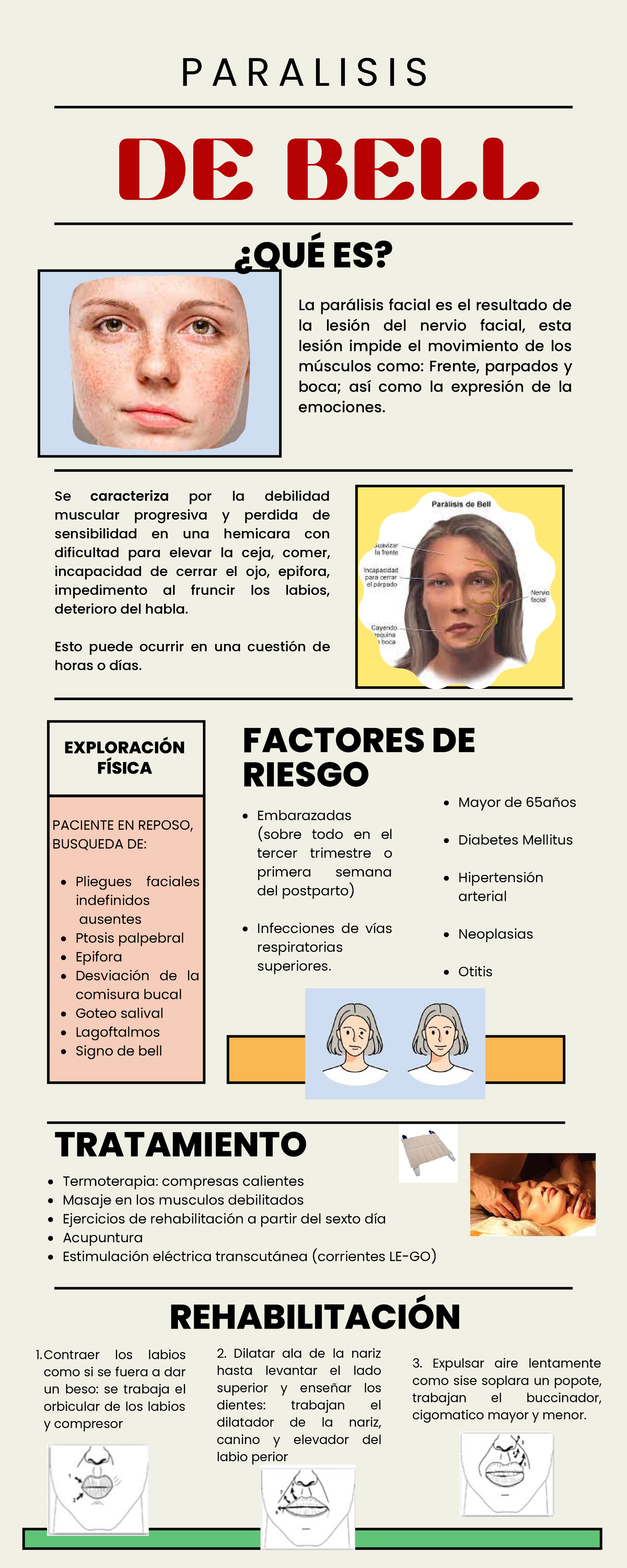 Paralisis De Bell Causas – Paralysie De Bell Causes Principales – PBXWHP