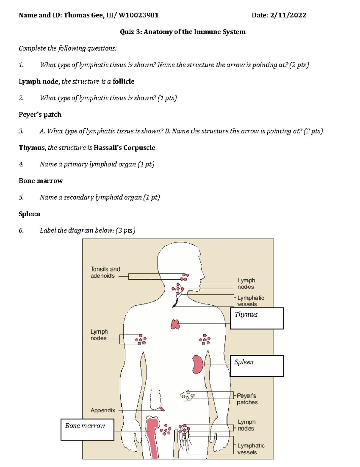 Quiz 3- Anatomy of the Immune System - Name and ID: Thomas Gee, III ...