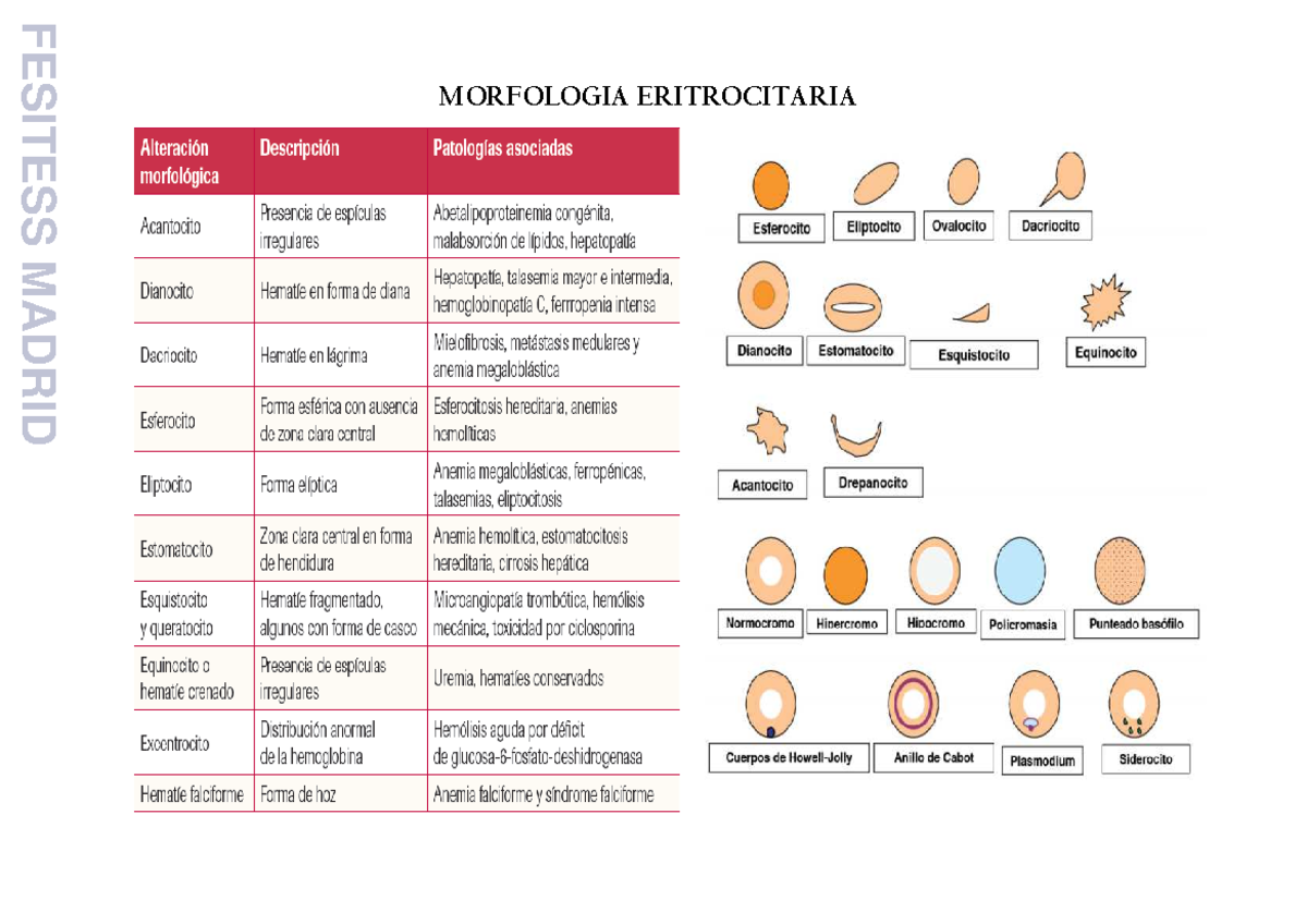 3. Anomalias Morfologicas (2) - MORFOLOGIA ERITROCITARIA ESFEROCITO Se ...