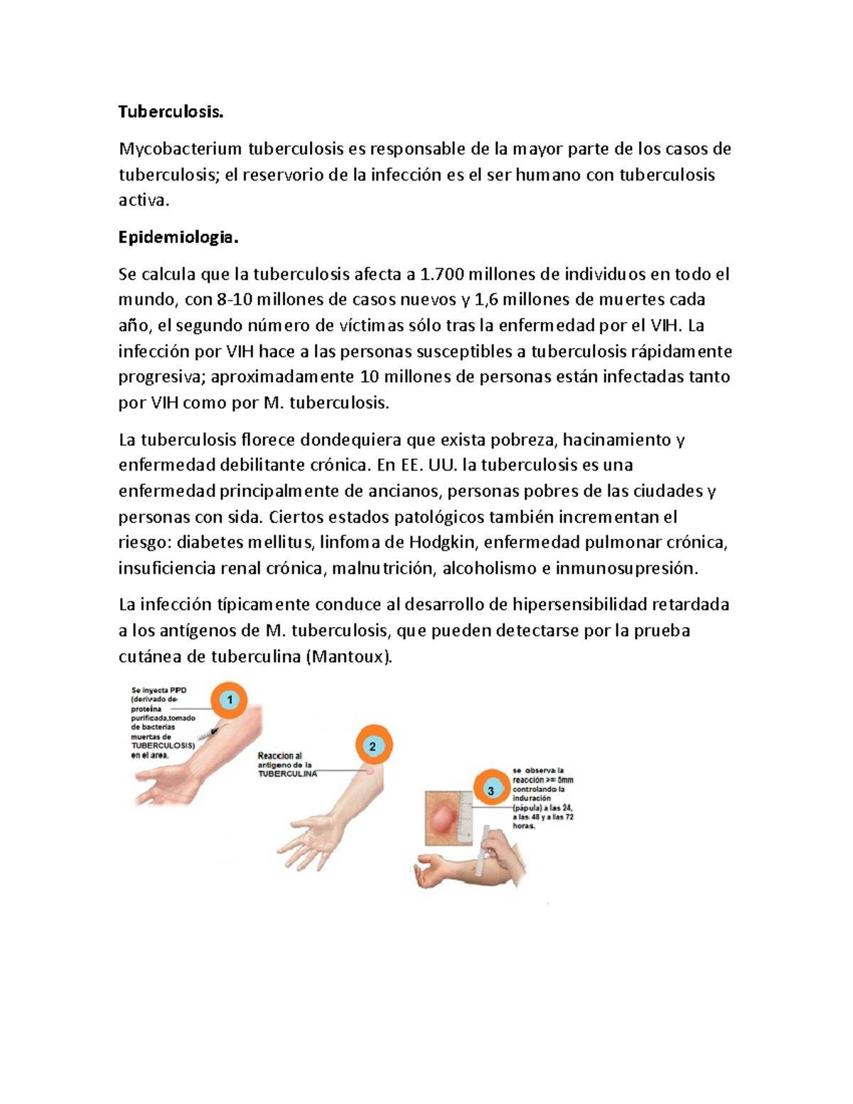 Tuberculosis exposicion - Tuberculosis. Mycobacterium tuberculosis es ...