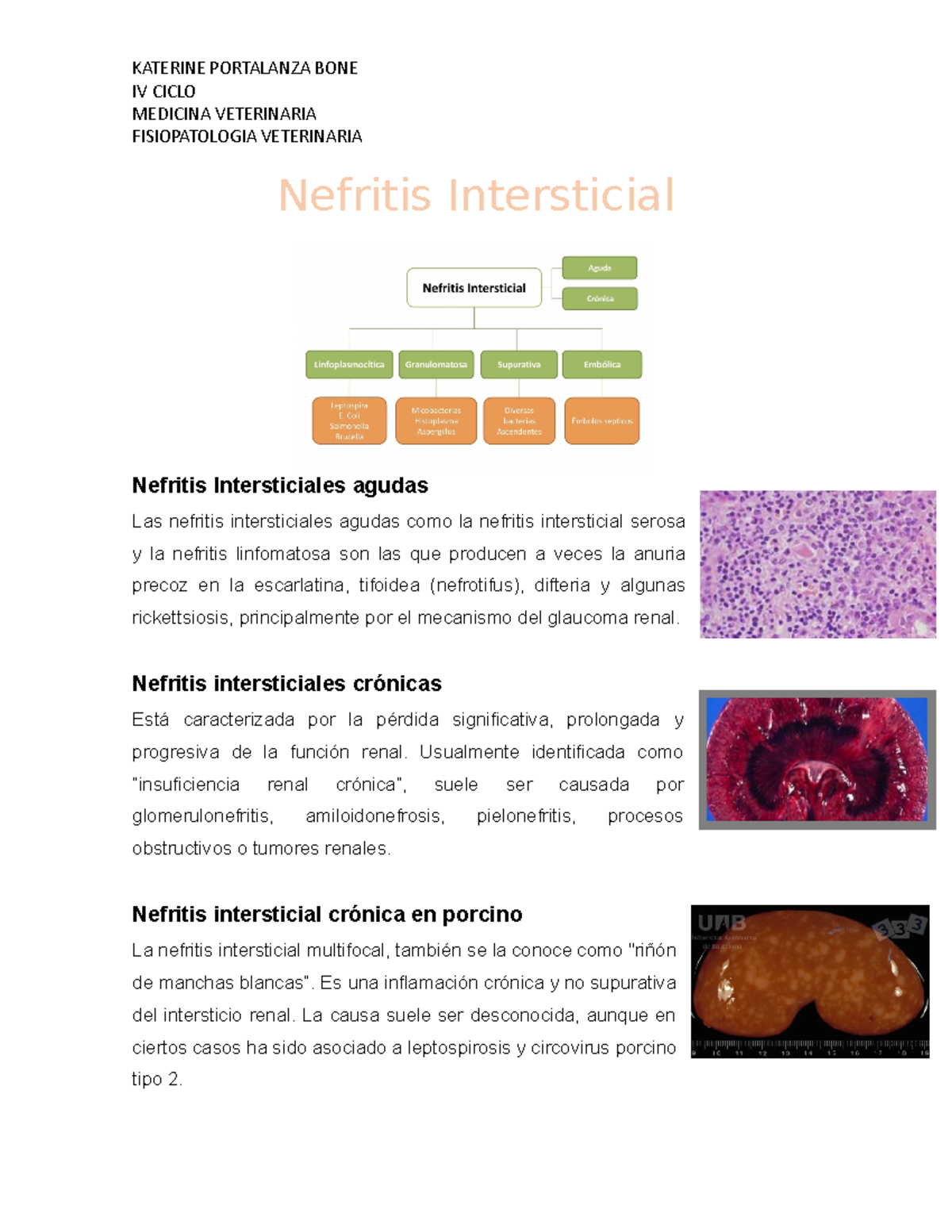 Nefritis Intersticial - Nefritis intersticiales crónicas Está caracterizada por la pérdida - Studocu
